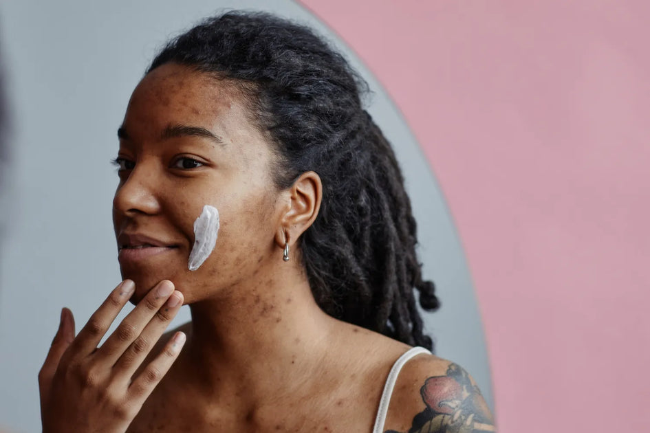 PCOS Acne: Understanding the Connection To Manage Effectively – Black ...